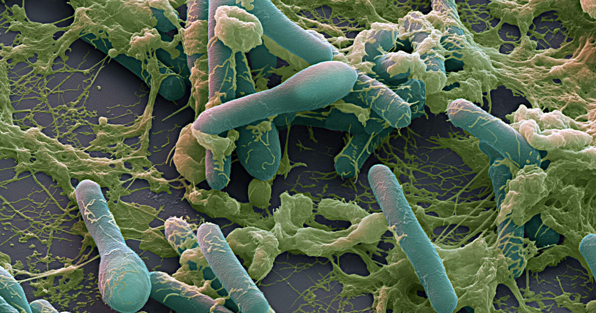 New Details Emerge on a Notorious Bird-Killing Bacteria | Audubon